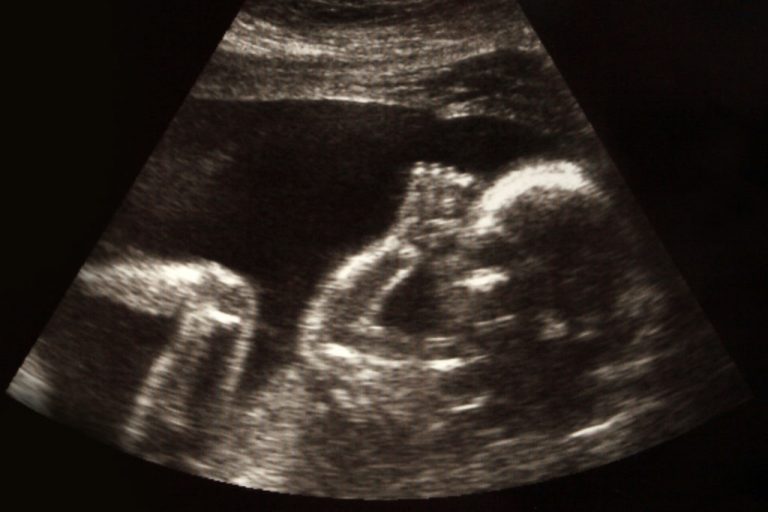 Christian Coalition of America – Christian Coalition of America